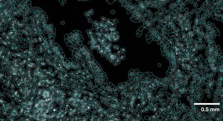 CosMx SMI Overview - Single-Cell Imaging - NanoString